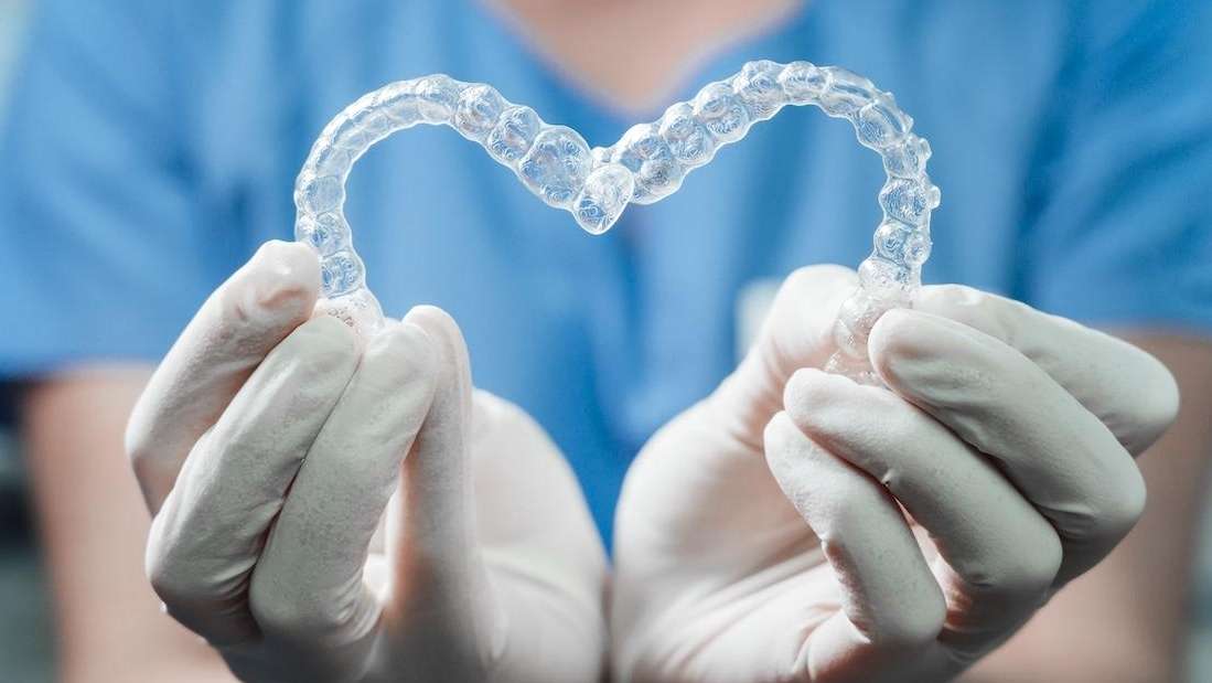 4 Benefits of Clear Aligner Therapy | Clear Aligners Cookeville TN